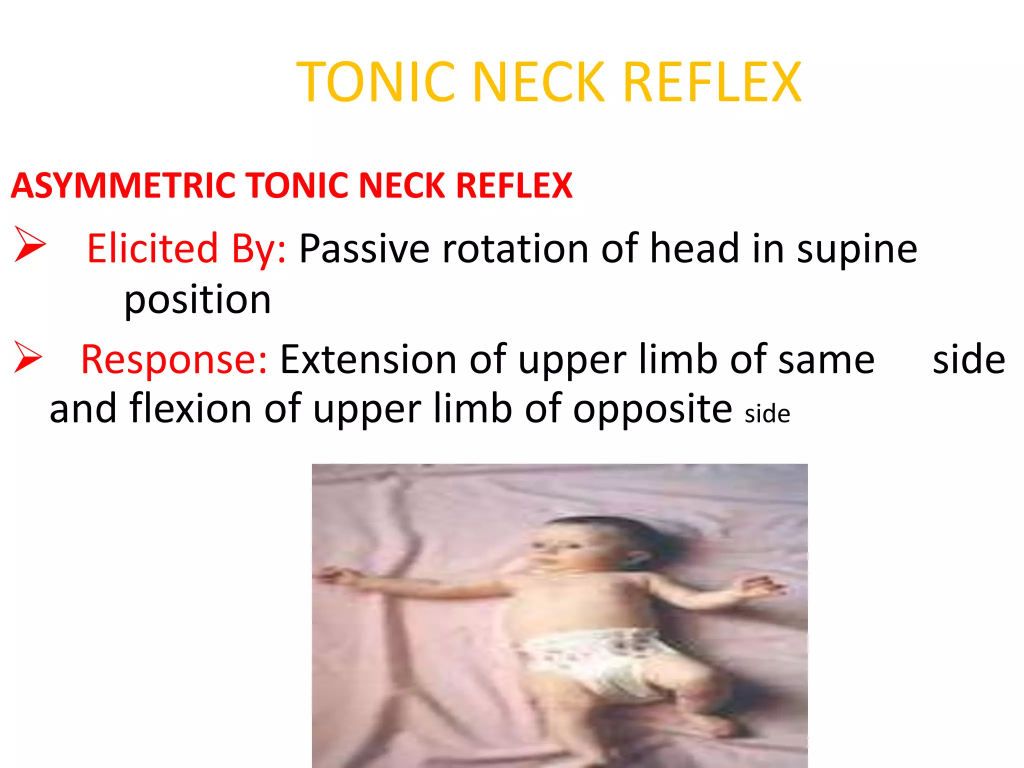 neonatal reflexes case presentation.pptx