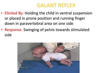 neonatal reflexes case presentation.pptx | Death, Injury, or Military ...