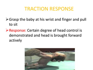 neonatal reflexes case presentation.pptx