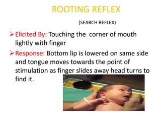 neonatal reflexes case presentation.pptx