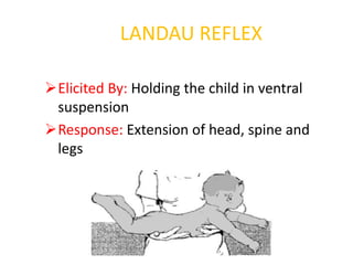 neonatal reflexes case presentation.pptx
