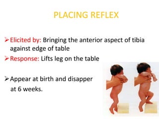 neonatal reflexes case presentation.pptx