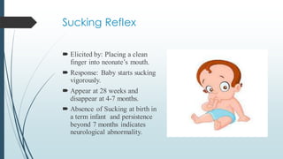 Comprehensive Guide to Primitive Neonatal Reflexes and Their Clinical ...