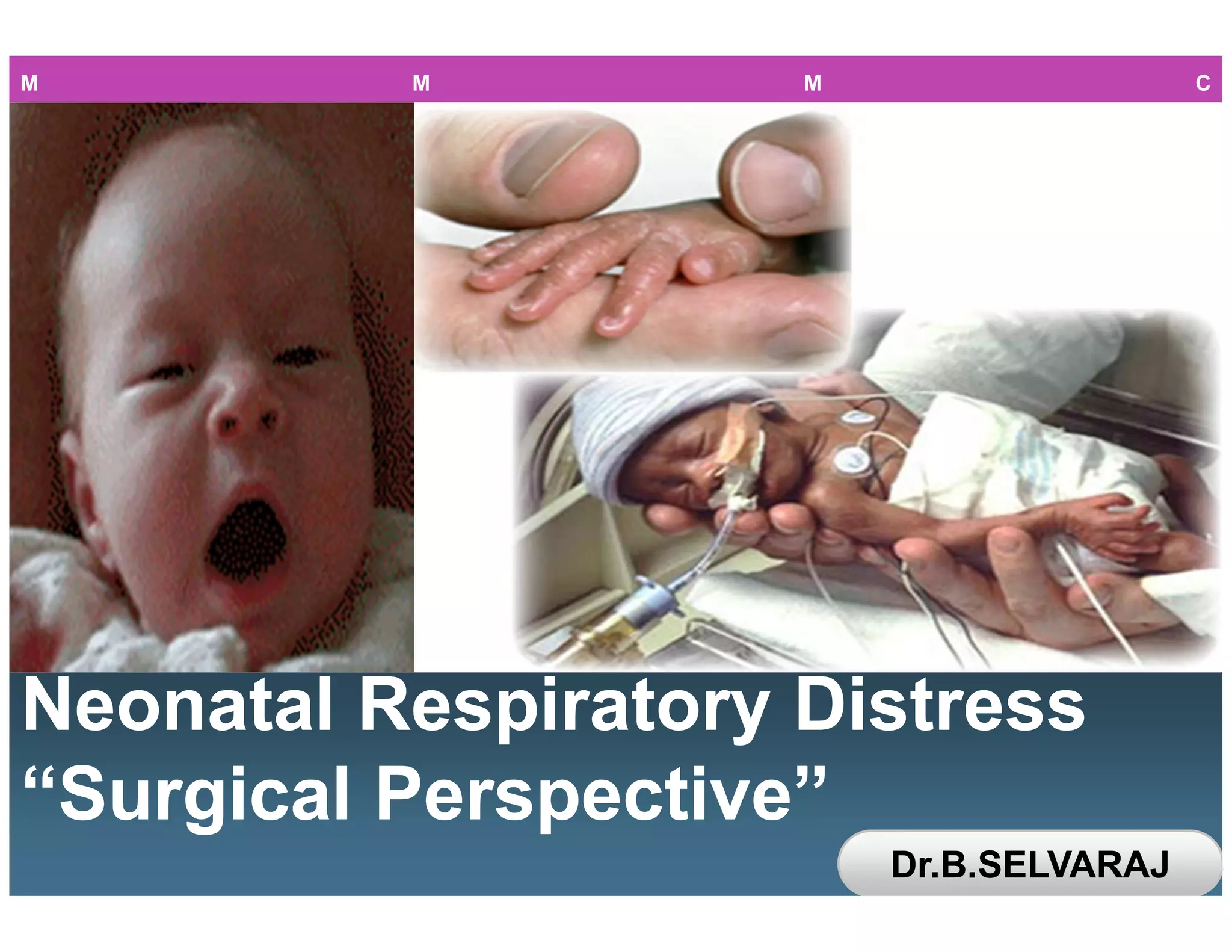 Neonatal respiratory distress- surgical perspective | PPT | Free Download