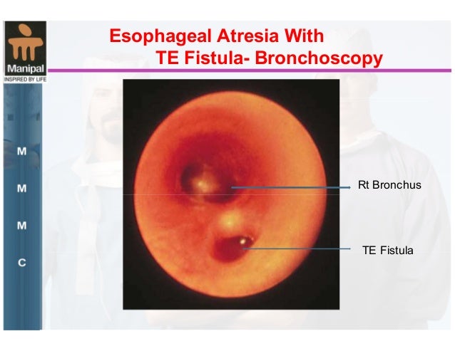 Neonatal respiratory distress- surgical perspective