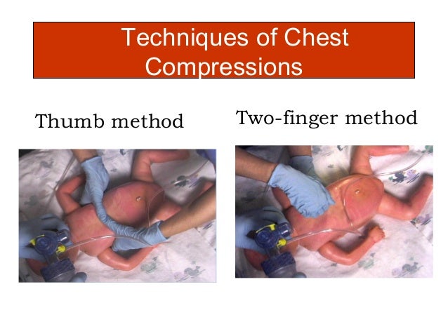 Neonatal resuscitation 2012 AG