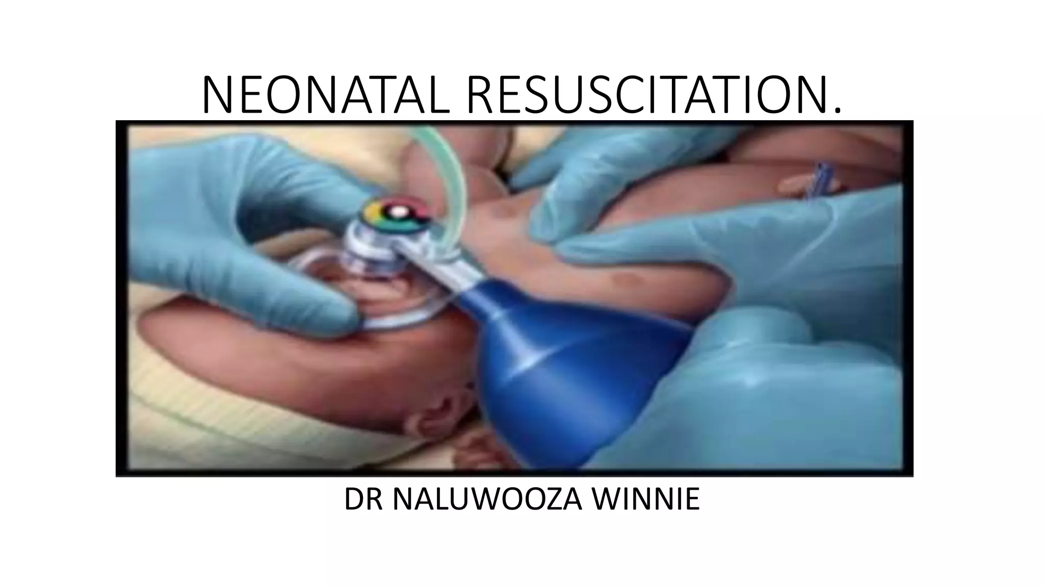 Neonatal Resuscitaion | PPT