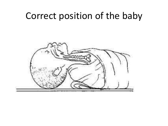 Neonatal Resuscitation Ventilation Bls Infant Techniques Correct ...