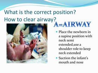 Neonatal resuscitation | PPTX