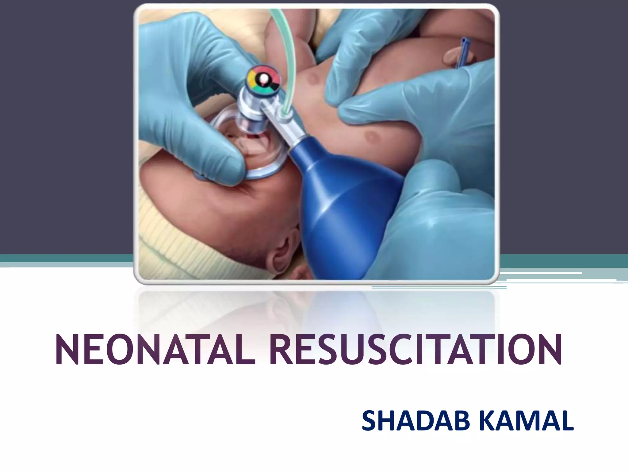 Neonatal resuscitation | PPTX