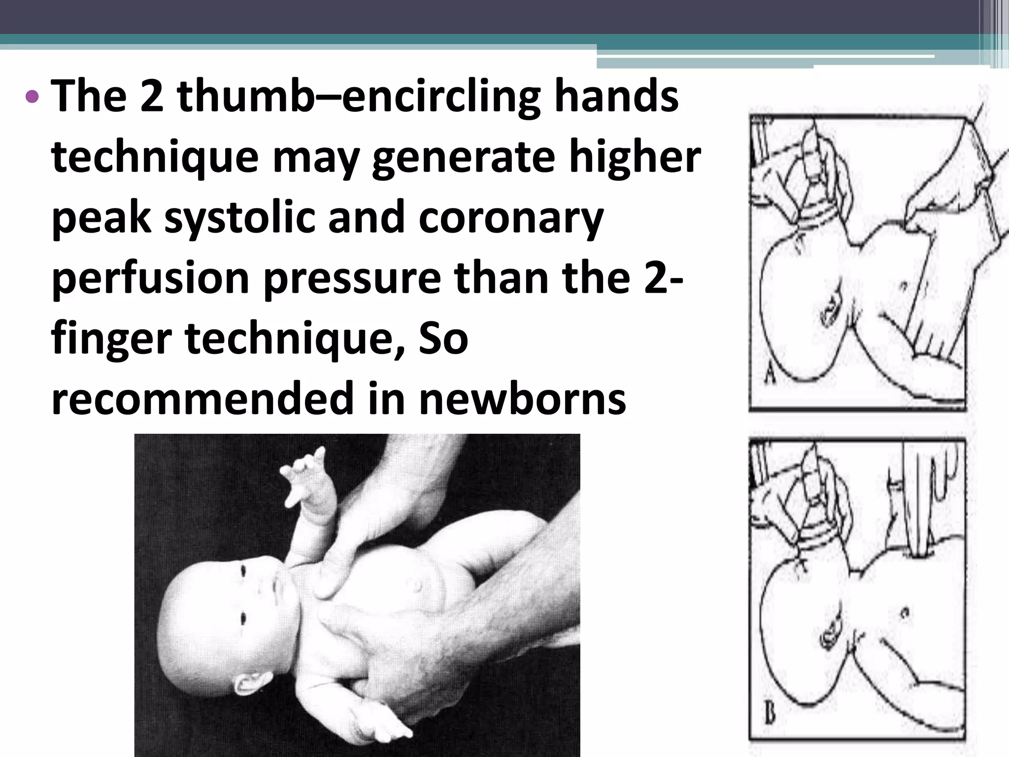 Neonatal resuscitation | PPTX
