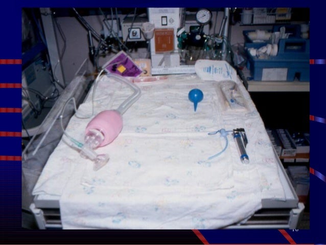 Neonatal resuscitation – DR. TRYNAADH