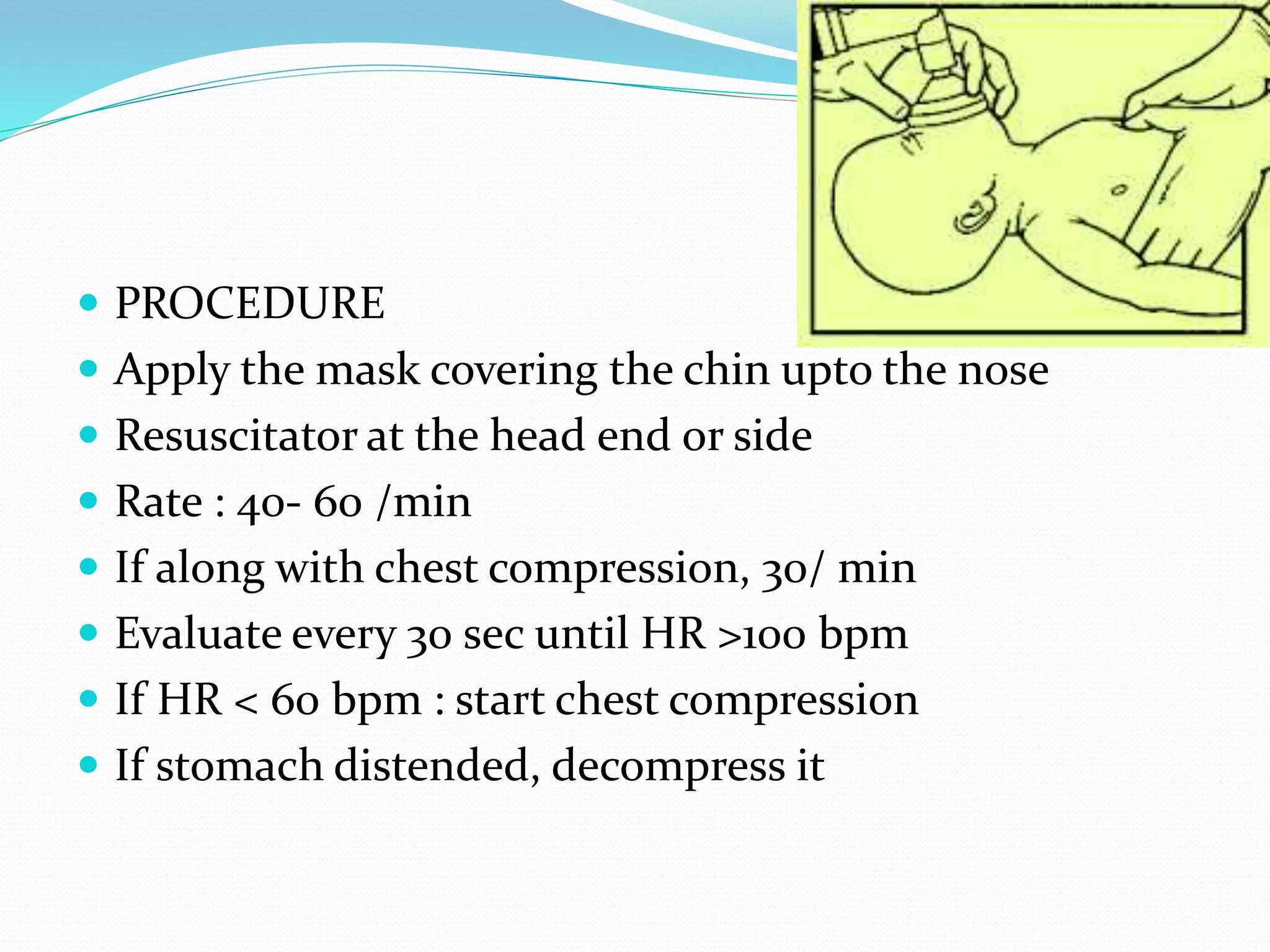 Neonatal resuscitation | PPTX