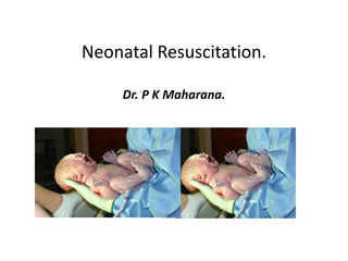 Neonatal resuscitation | PPTX