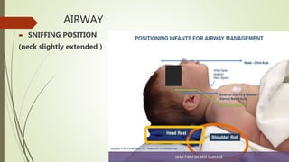 Neonatal resuscitation | PPTX | First Aid | Injuries