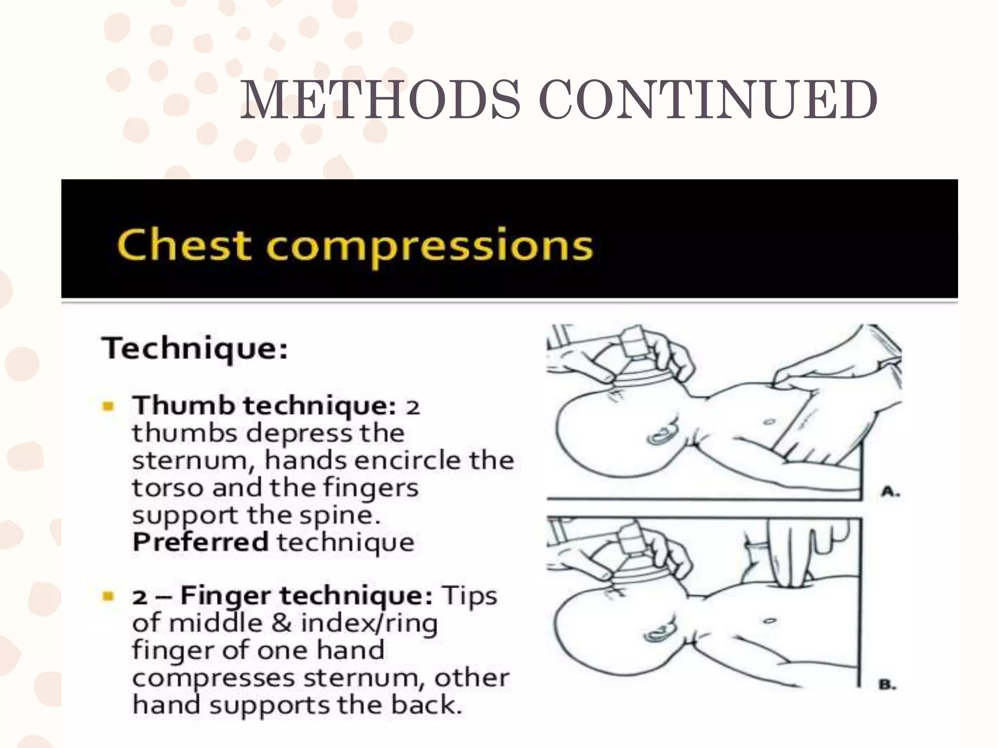 Neonatal resuscitation | PPTX