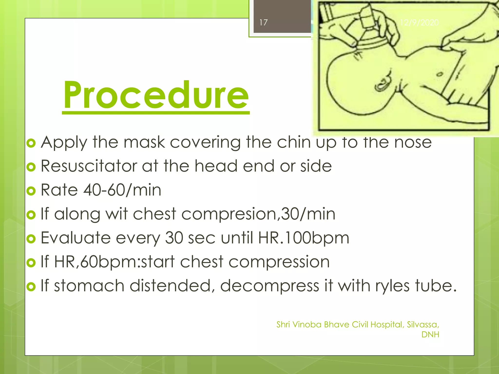 Neonatal resuscitation / Neonatal Resuscitation | PDF