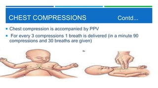Neonatal Resuscitation.pptx