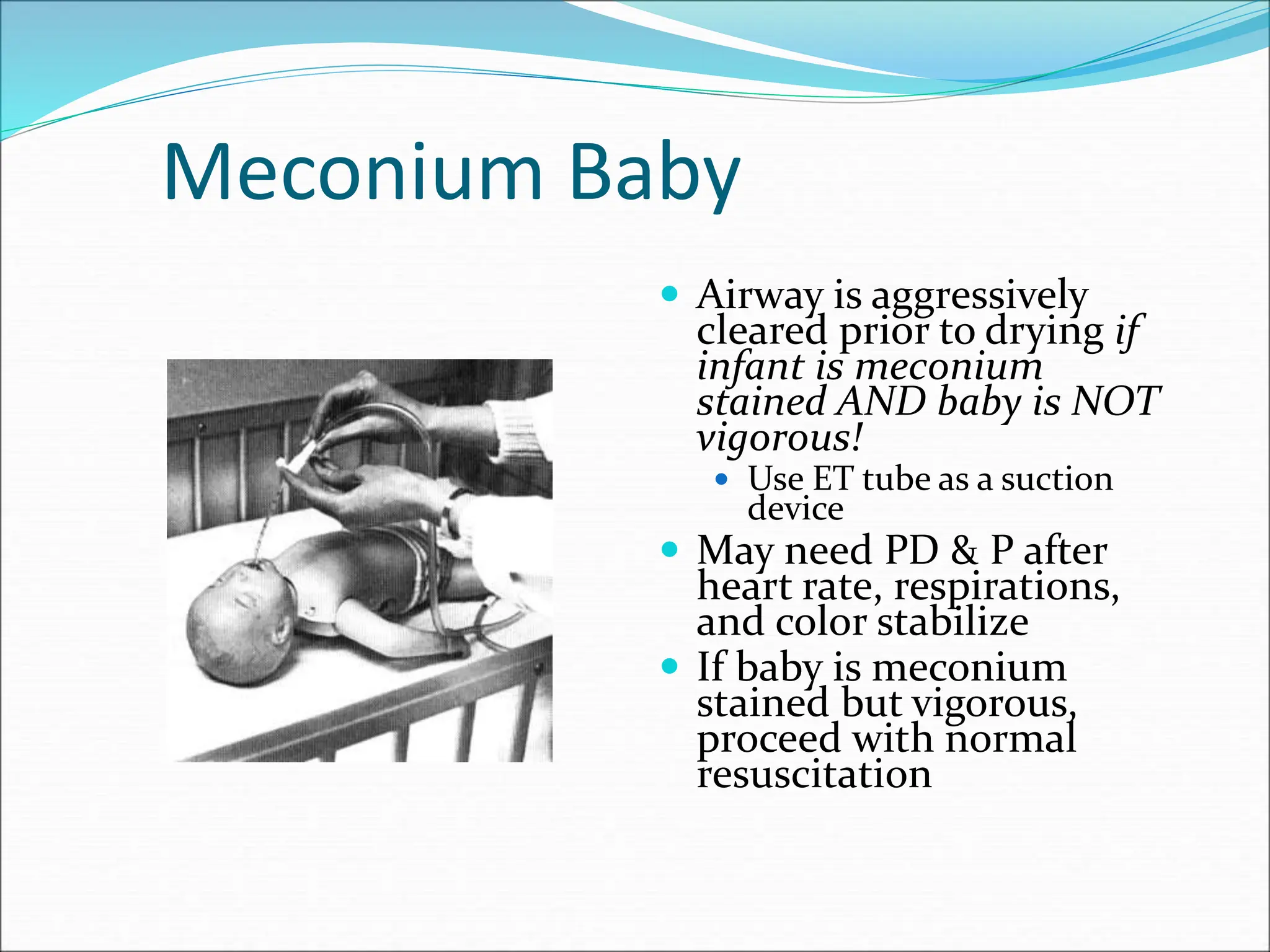 NEONATAL RESUSCITATION.ppt
