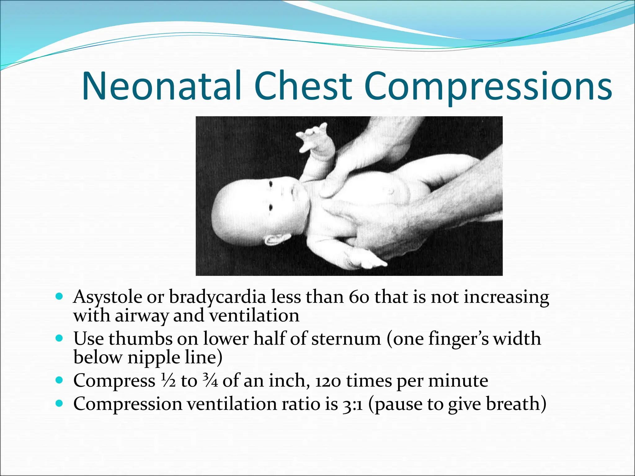 NEONATAL RESUSCITATION.ppt