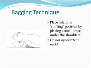 NEONATAL RESUSCITATION.ppt