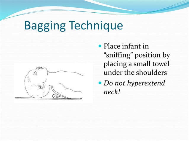 NEONATAL RESUSCITATION.ppt