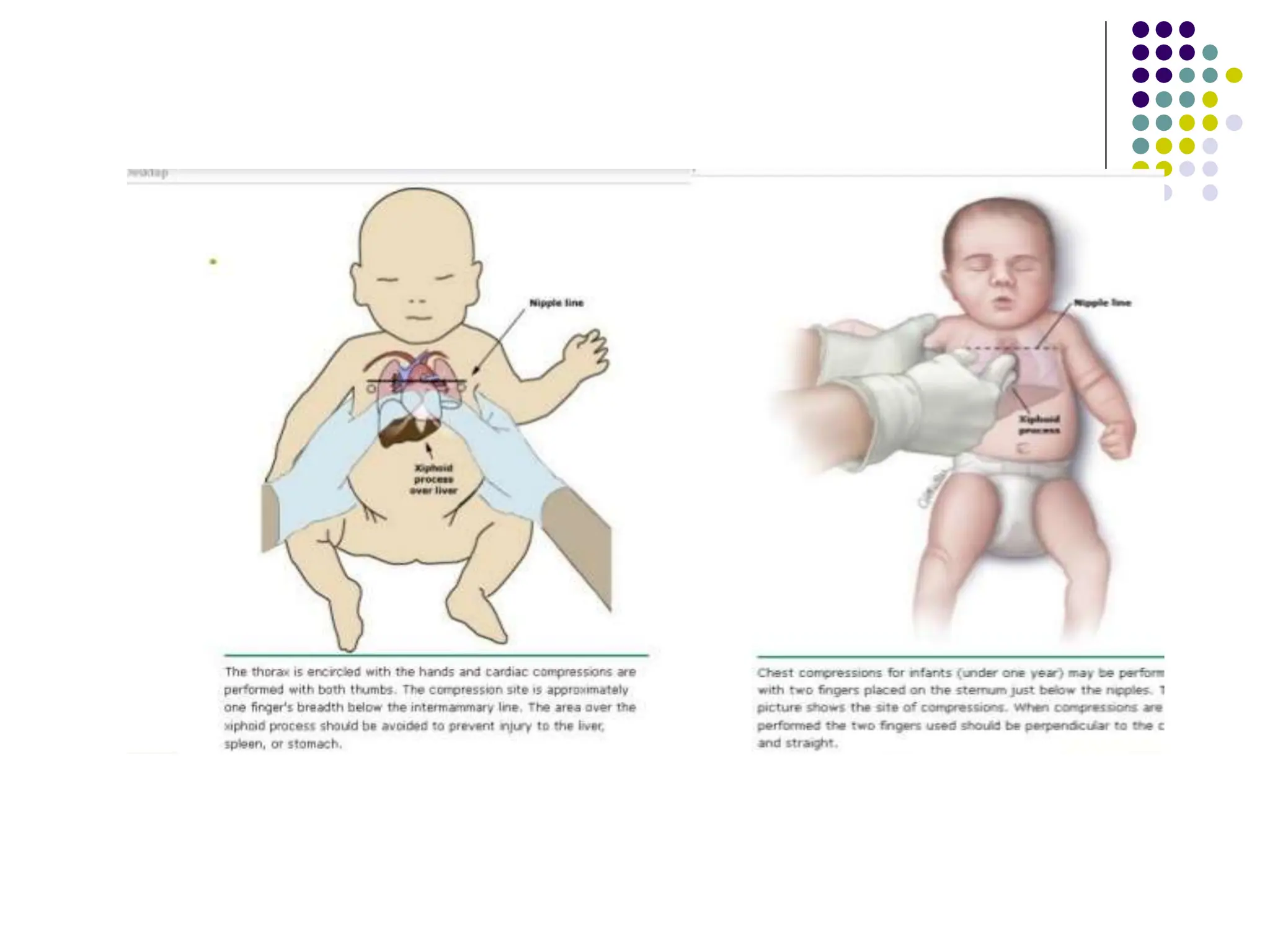 Neonatal Resuscitation Paediatrics Neonatology.pptx
