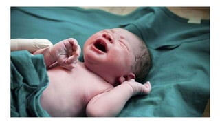 Neonatal resuscitation and birth asphyxia | PPTX