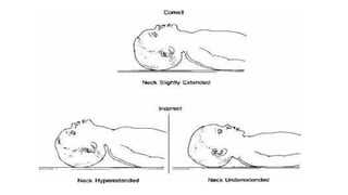 Neonatal resuscitation.pptx newborn care | PPTX