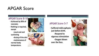 Neonatal Resuscitation power point for obgyn | PPTX