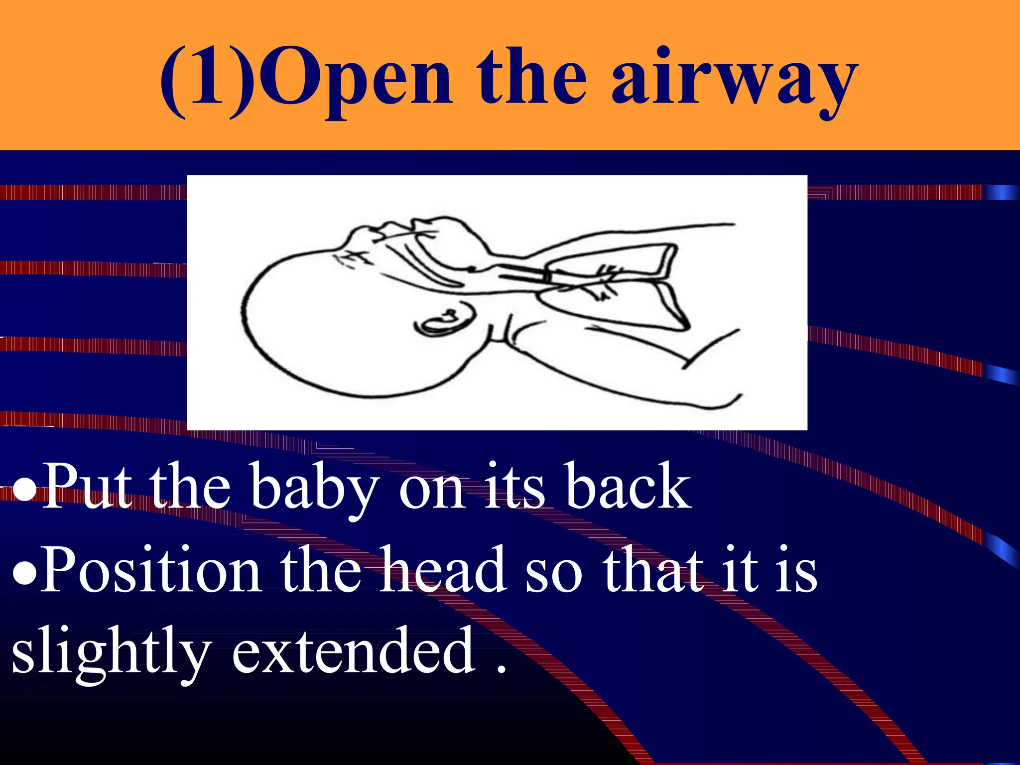 neonatal resuscitation(1).pptx in obstetrics and gynecology | PPTX