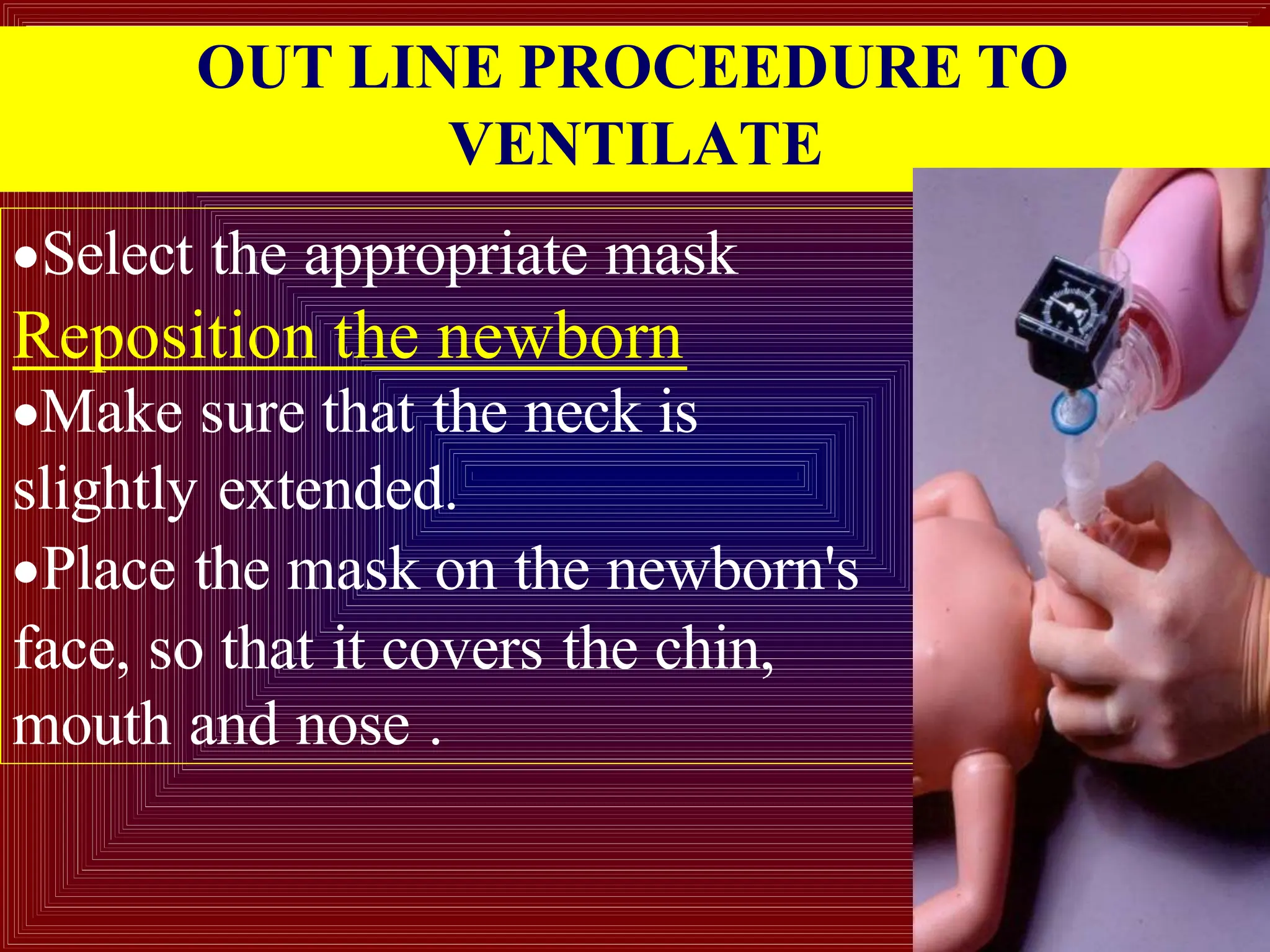 neonatal resuscitation(1).pptx in obstetrics and gynecology | PPTX