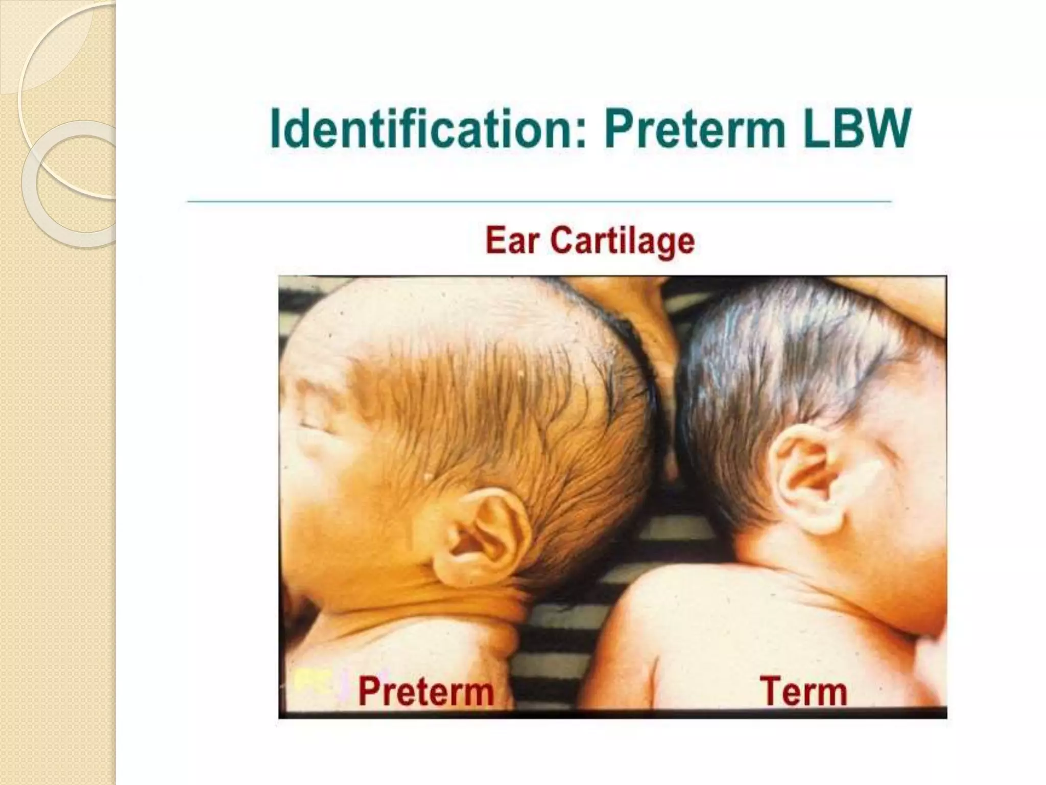 NEONATAL RESUSCITATION AND LOW BIRTH WEIGHT BABIES | PPT