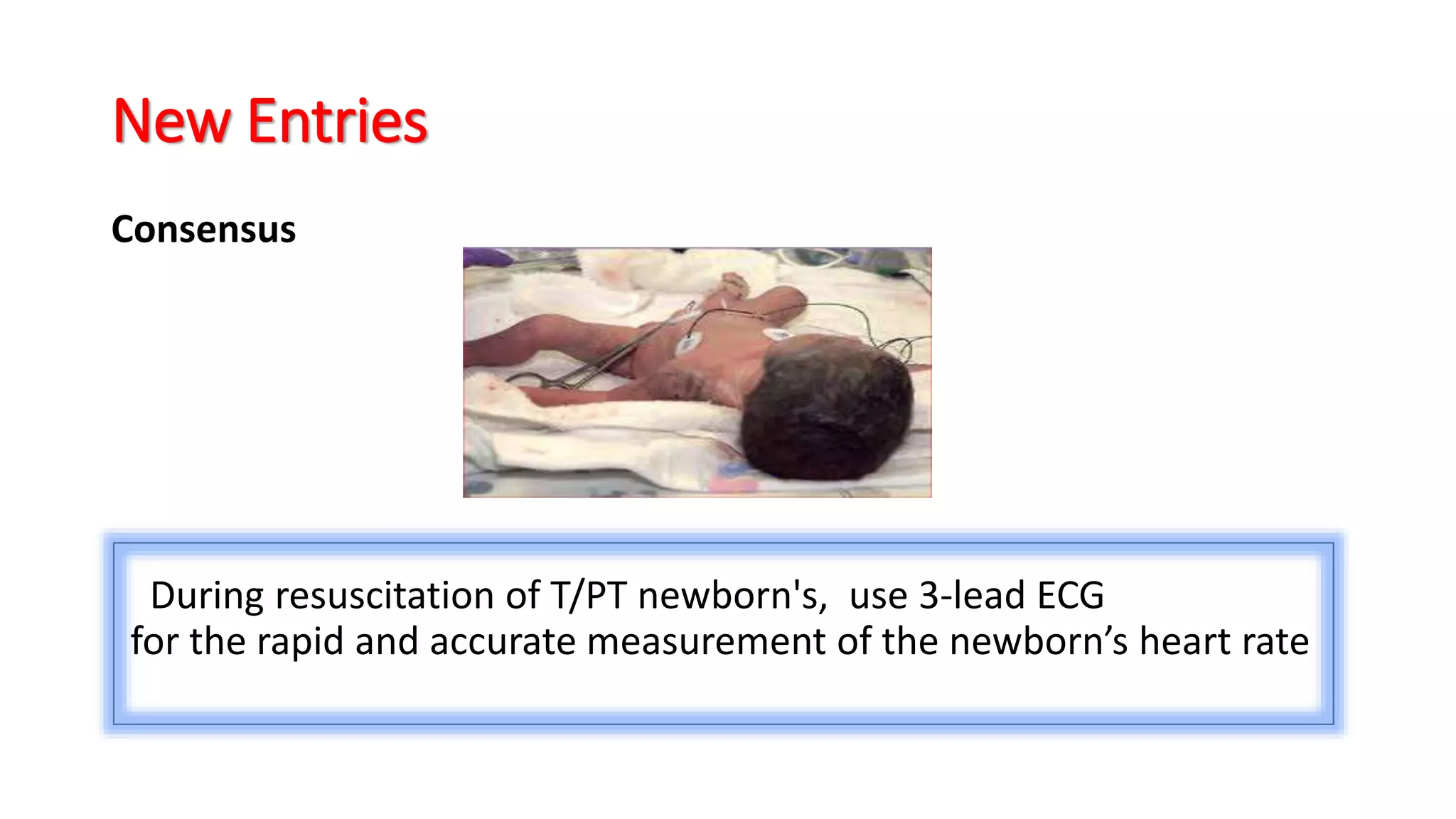 Neonatal resuscitation guidelines 2015 | PPTX