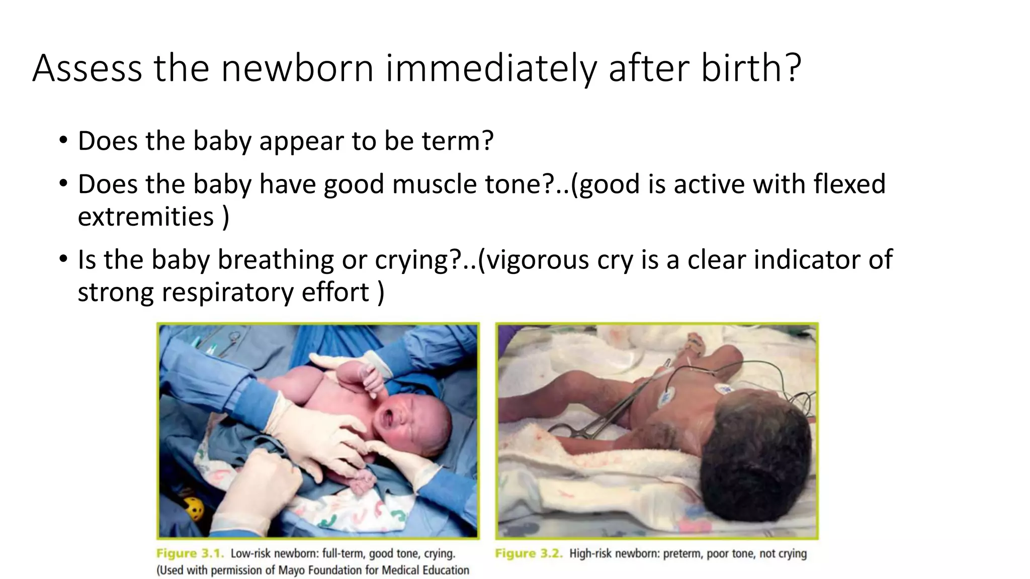 Neonatal Resuscitation Program NRP | PPTX