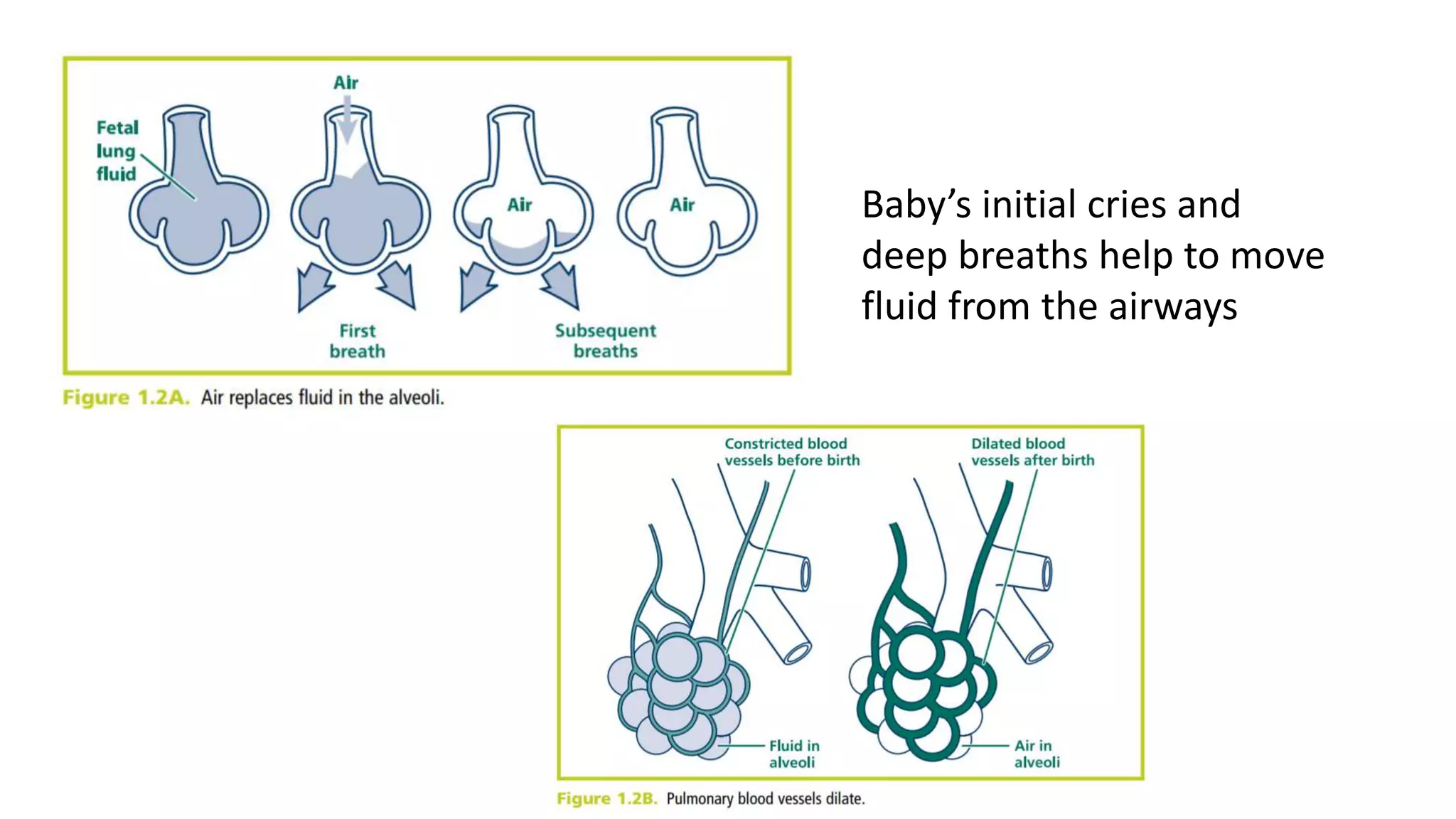 Neonatal Resuscitation Program NRP | PPTX