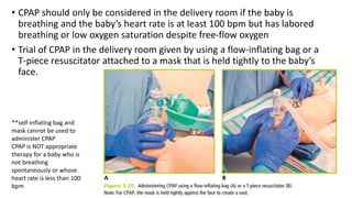 Neonatal Resuscitation Program NRP | PPTX