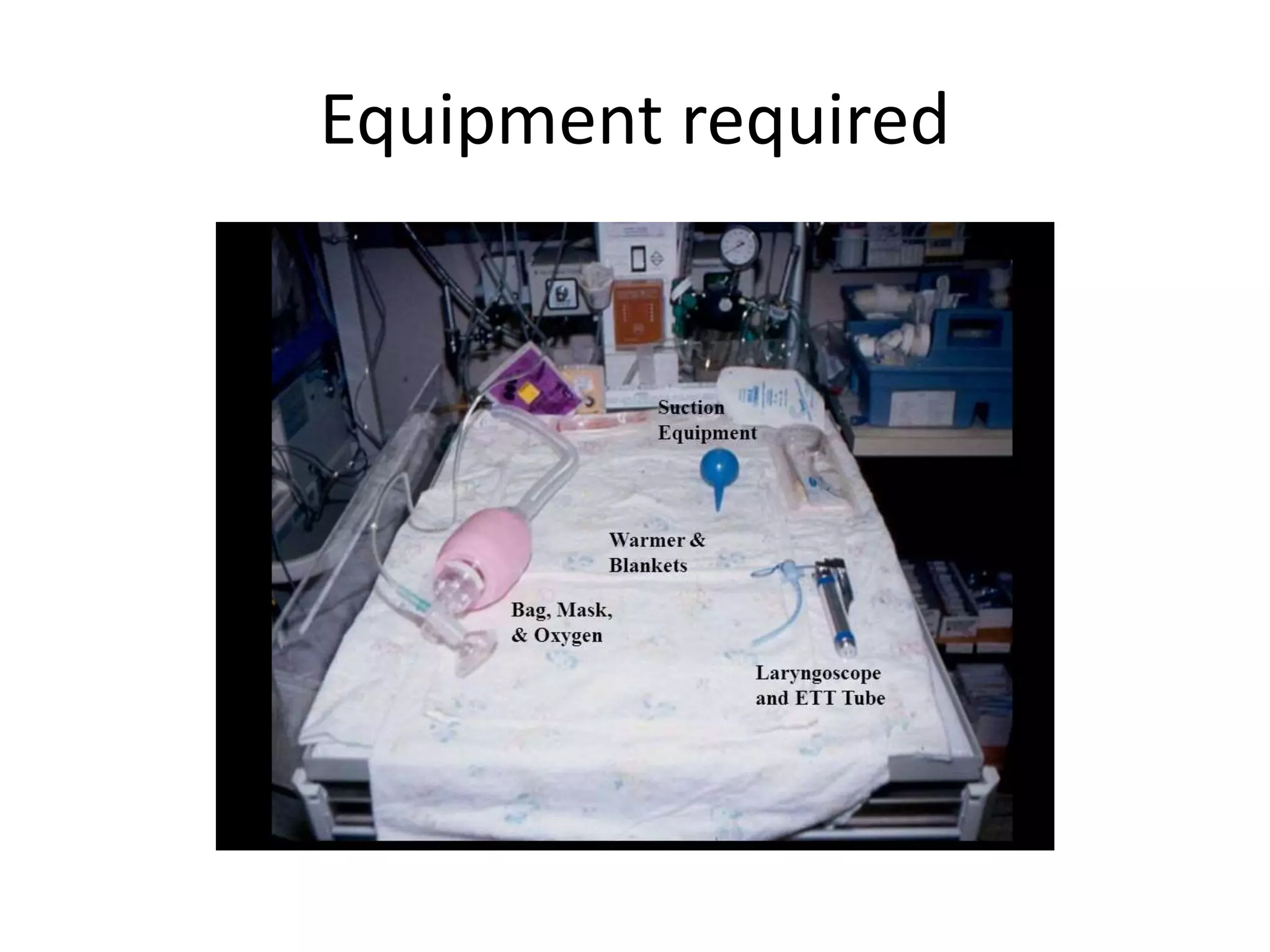 Neonatal resuscitation | PPTX