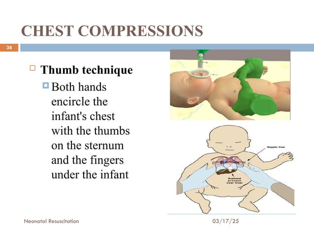 Neonatal Resuscitation Presentation (1).ppt