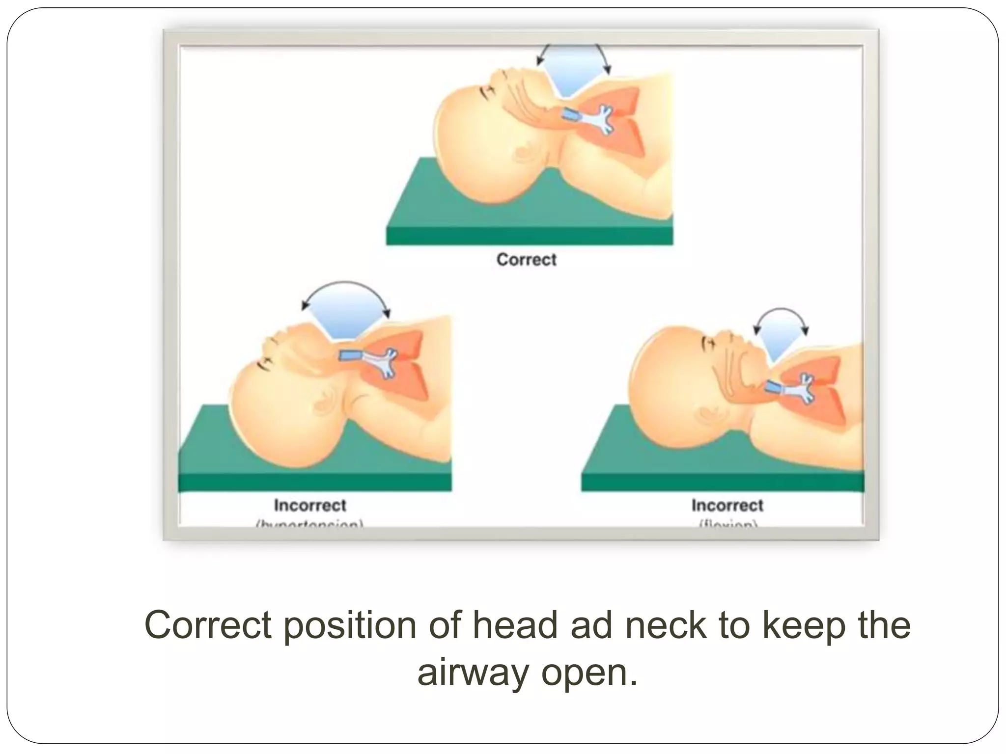 NEONATAL RESUSCITATION PROGRAM.pptx