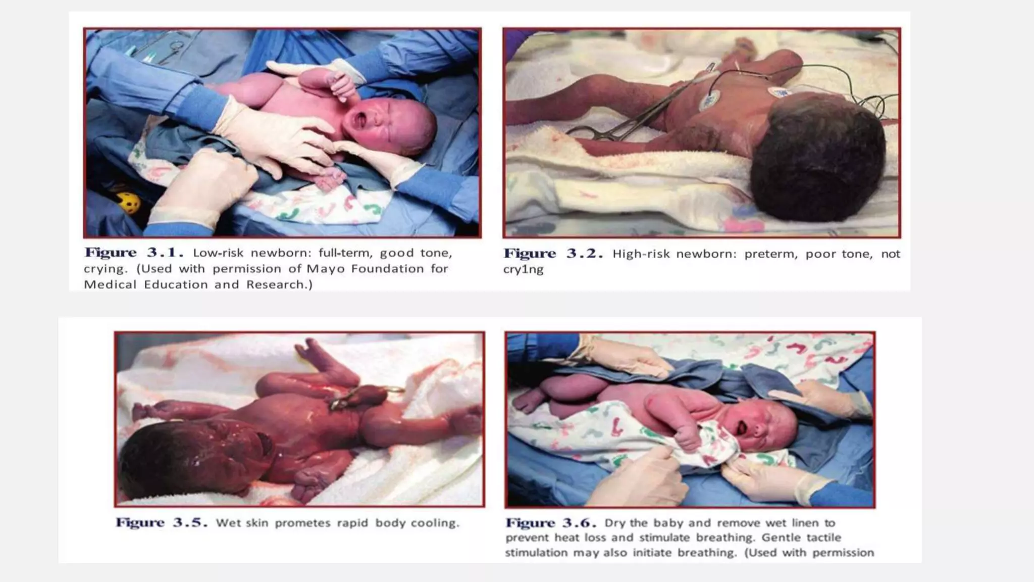 Neonatal resuscitation program 8 th edition updates | PPTX | First Aid ...