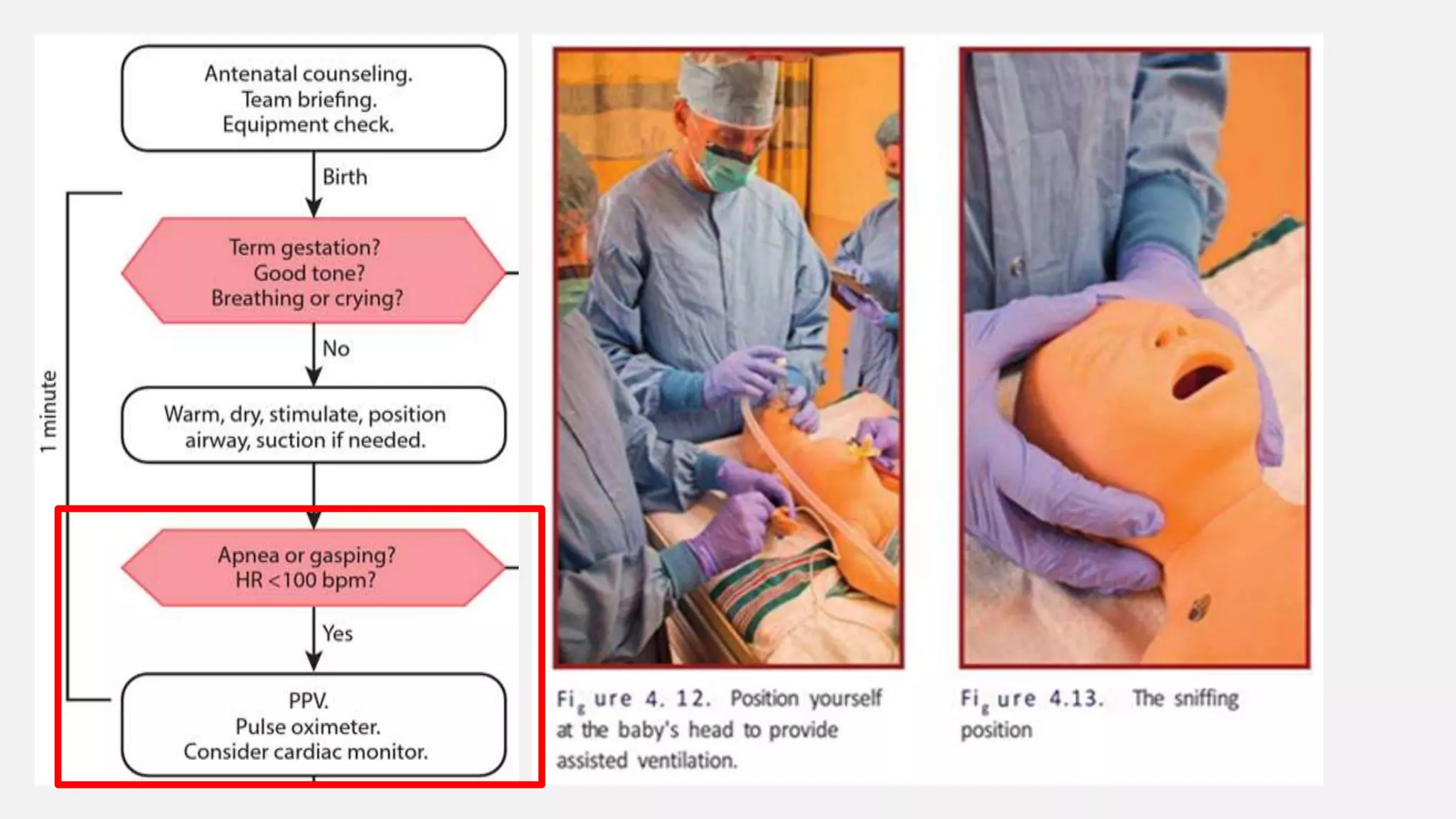 Neonatal resuscitation program 8 th edition updates | PPTX | First Aid ...