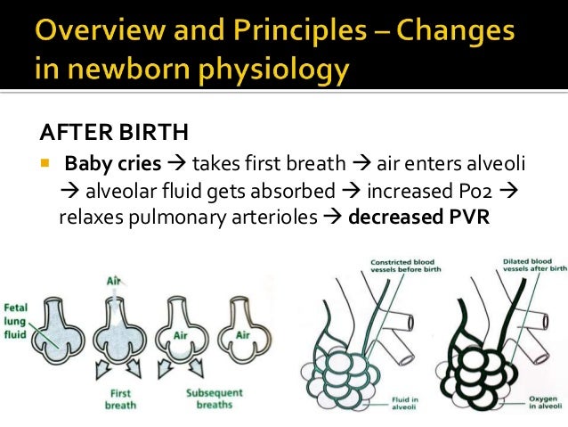 Neonatal resuscitation programme, NRP