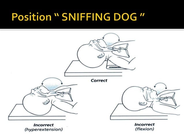 Neonatal resuscitation programme, NRP