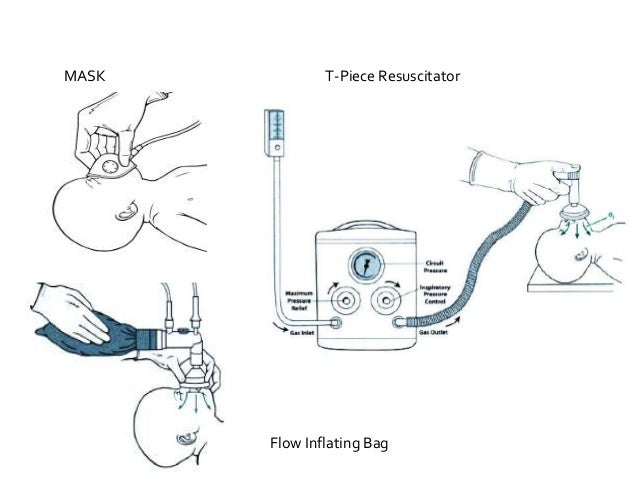 Neonatal Resuscitation Programme Nrp