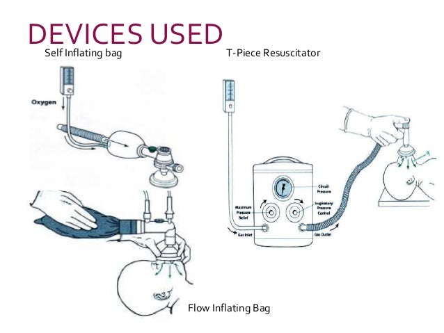 Neonatal resuscitation programme, NRP