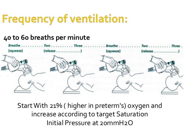 Neonatal resuscitation programme, NRP