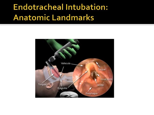 Neonatal resuscitation programme, NRP