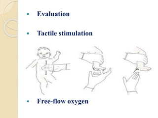Neonatal Resuscitation | PPT