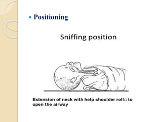 Neonatal Resuscitation | PPT